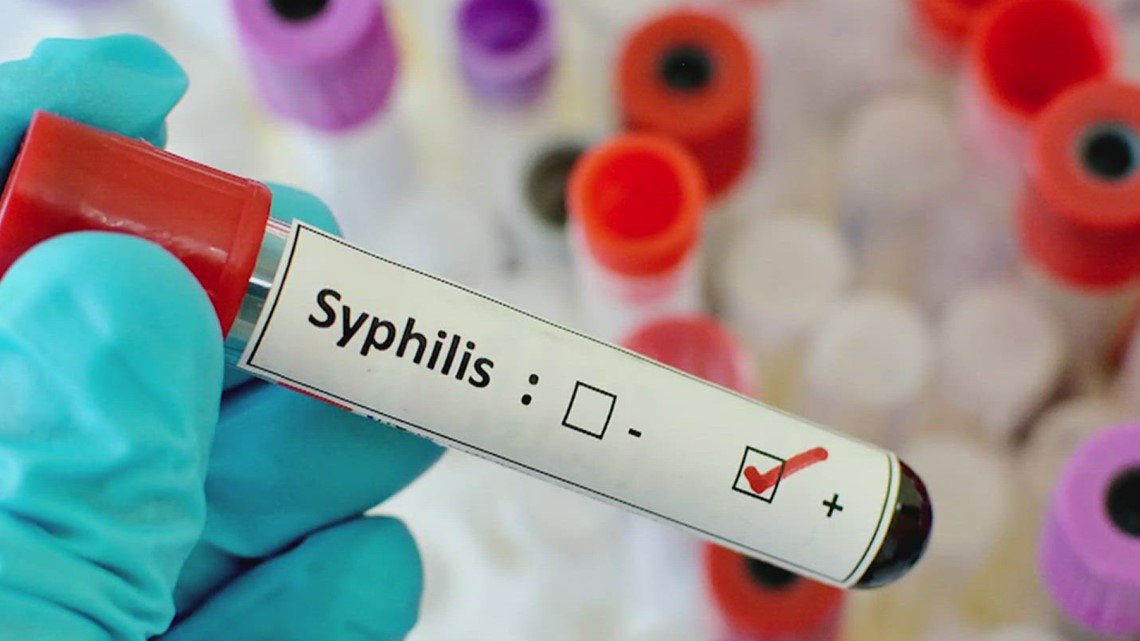 Rising syphilis cases in Nueces County prompt urgent focus | kiiitv.com