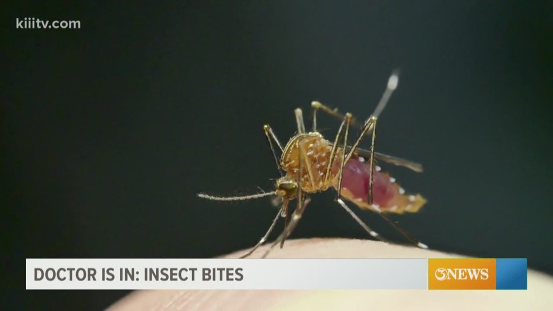 The Dr. Is In - Insect bites | kiiitv.com