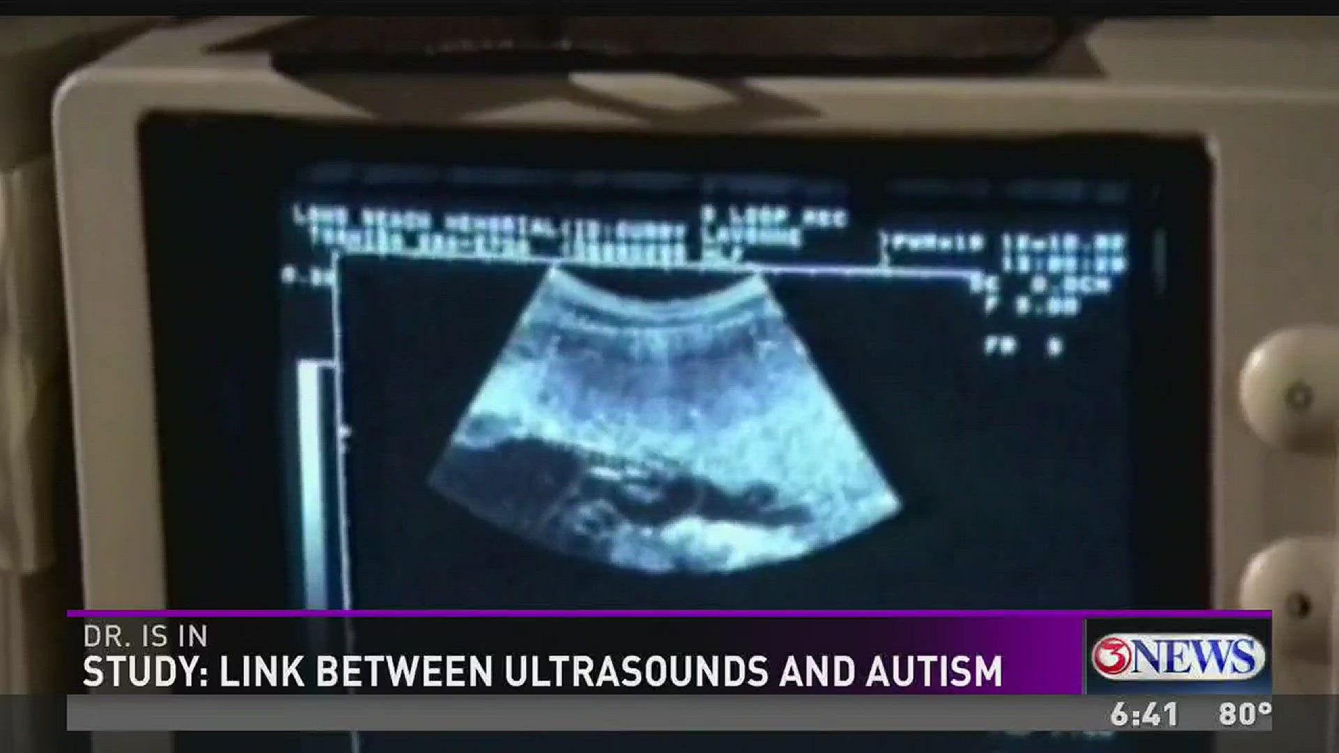 Ultrasound in first trimester linked to severity of autism symptoms ...