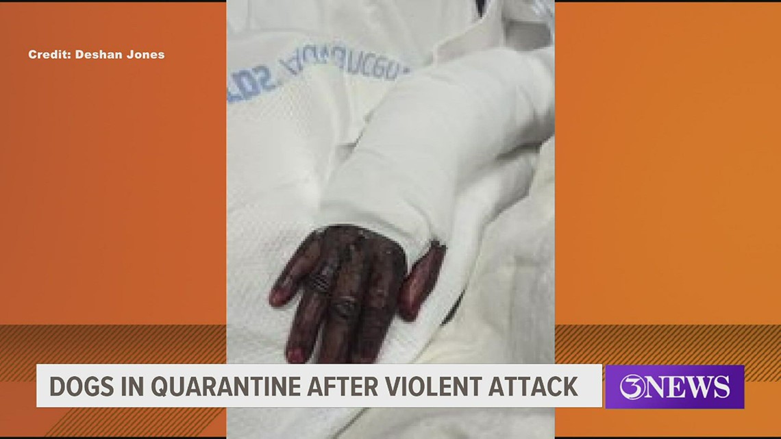 Dog attack near Rose Shaw Elementary leaves woman hospitalized | kiiitv.com