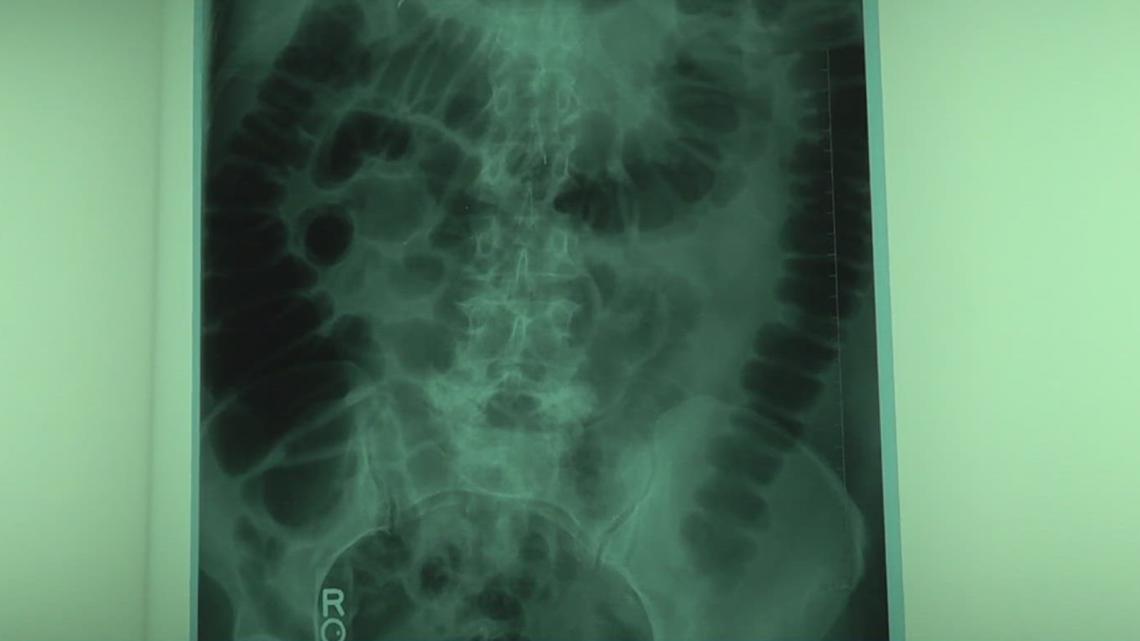 Del Mar College celebrates advancements of Radiologic Technology ...