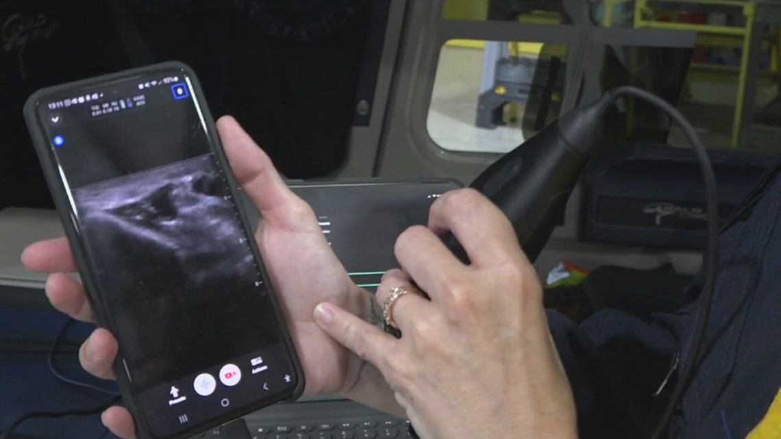 HALO-Flight announces new ultrasound technology system | kiiitv.com