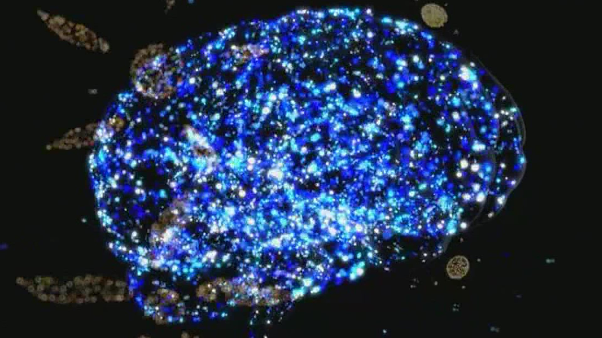 Deep brain stimulation to treat addiction | kiiitv.com